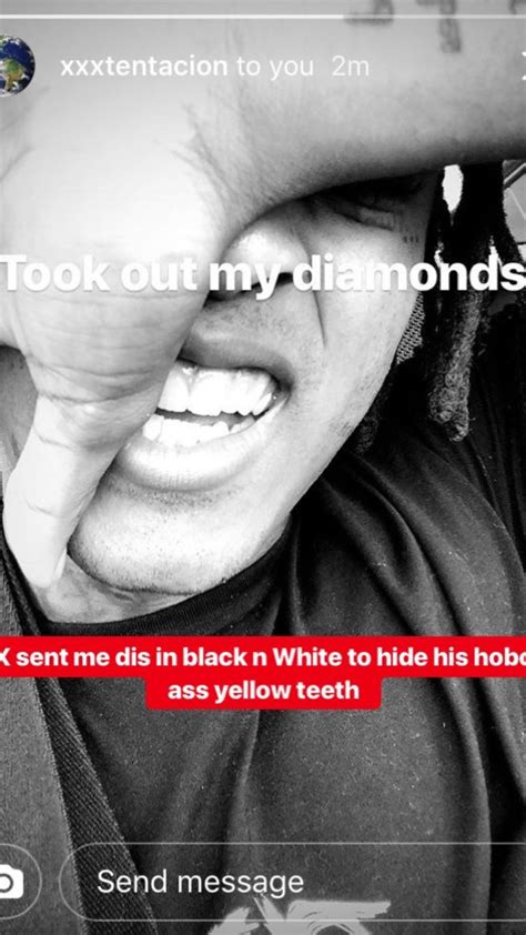 X Took His Grills Out Rxxxtentacion