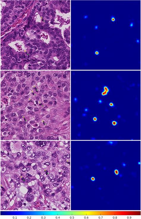 Example Results From The Automatic Mitosis Detection Algorithm In The
