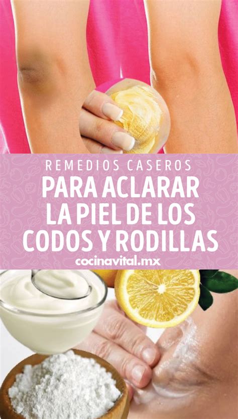 Remedios Caseros Para Aclarar La Piel De Los Codos Y Rodillas Artofit