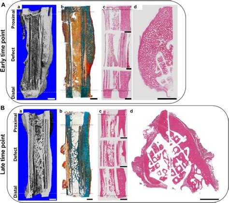 Scaffold Guided Bone Regeneration In Large Volume Tibial Segmental Defects Biofabrication And