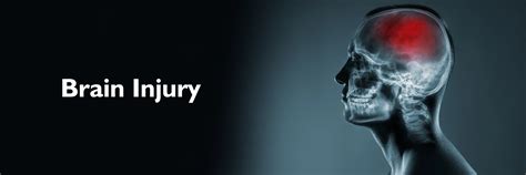 Traumatic Brain Injury Long Term Effects Symptoms And OFF