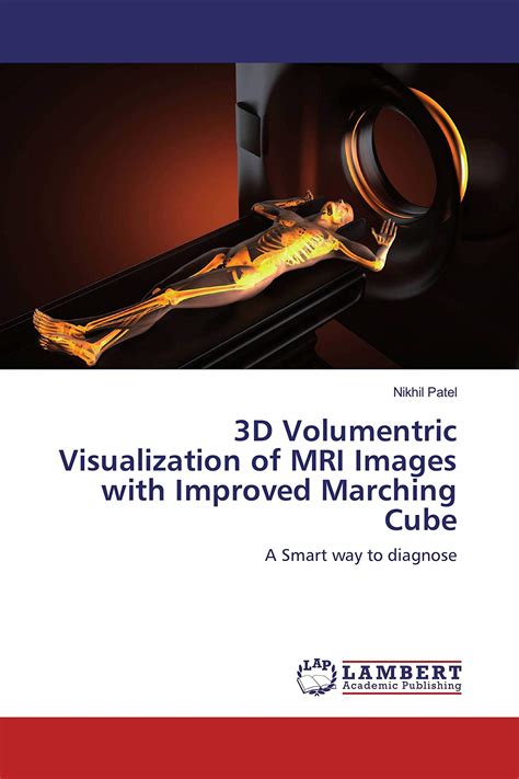 Buy 3d Volumentric Visualization Of Mri Images With Improved Marching Cube A Smart Way To