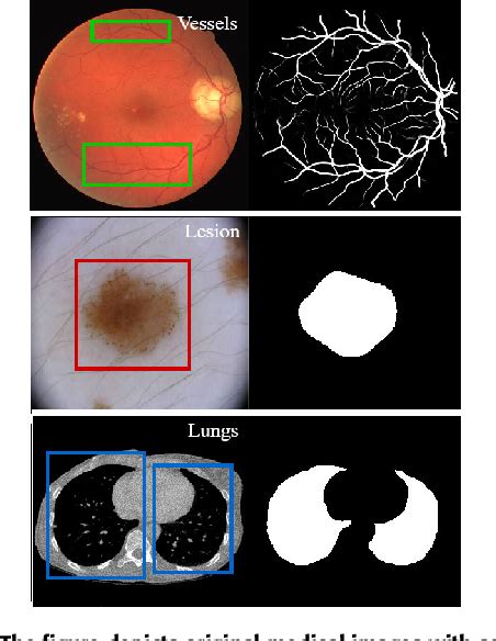 Table 2 From Deep Neural Architectures For Medical Image Semantic Segmentation Review