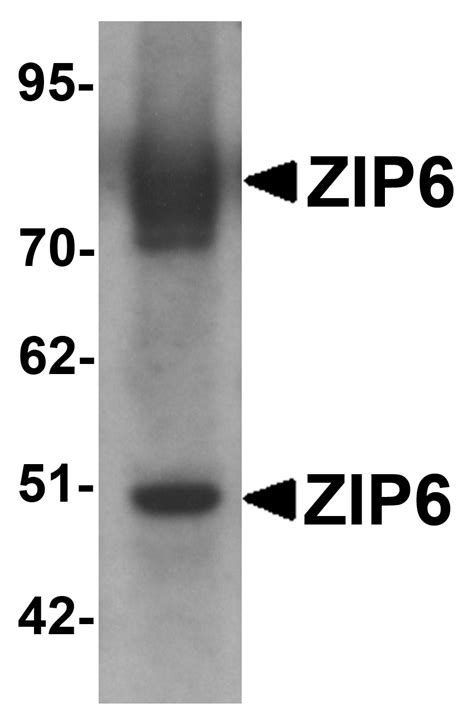 Zip6 Antibody Cat No 6091 Prosci