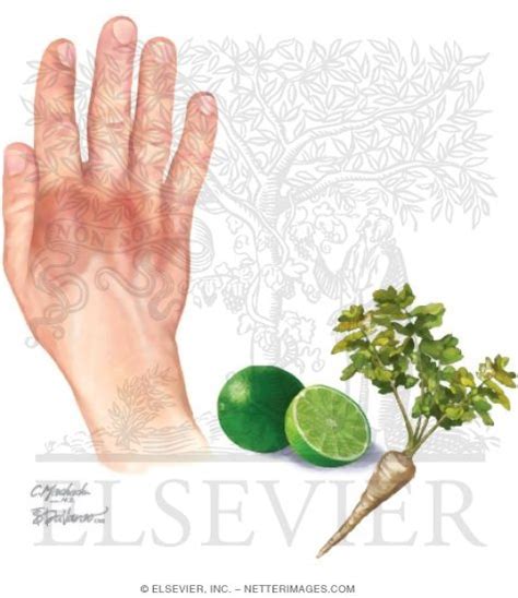 Phytophotodermatitis