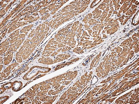A Actin081tissue Micro Arrays