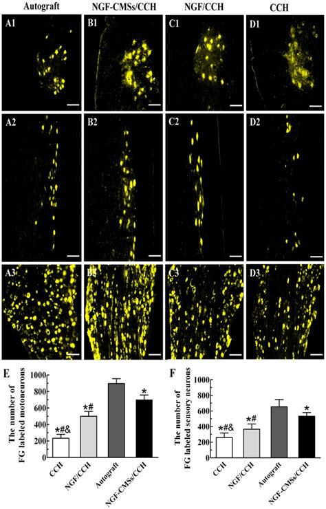 Micrographs Of Fg Labeled Motoneurons In Spinal Cord Transverse Download Scientific Diagram