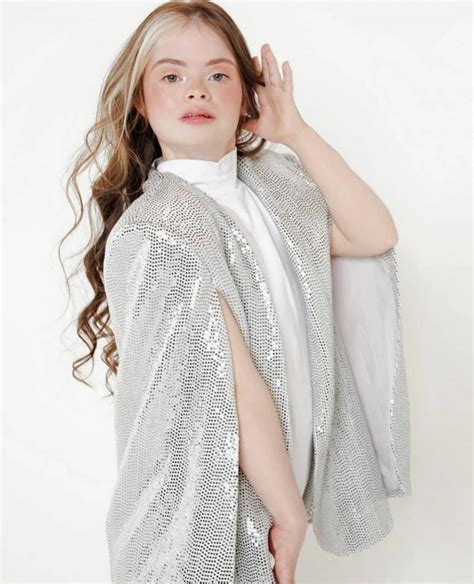 Success Story Of A Model With Downs Syndrome Young Girls Photoshoot