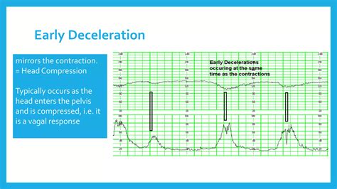 Ctg Interpretation Pptx