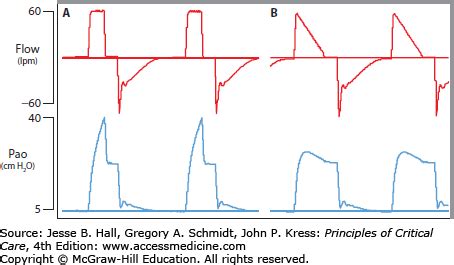 Ventilator Waveforms Clinical Interpretation Anesthesia Key