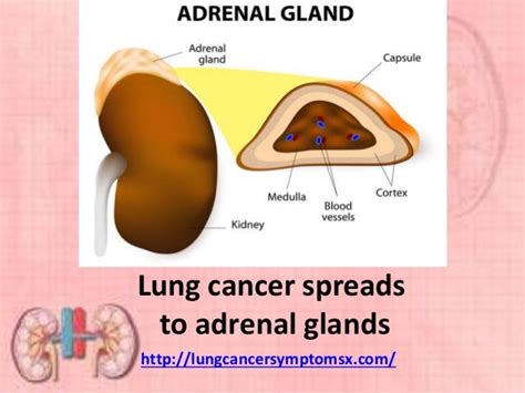 Adrenal Gland Cancer Cancerwalls