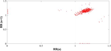 Determination Of Maximum Noise Level In An ECG Channel Under SURE Wavelet Filtering For HRV