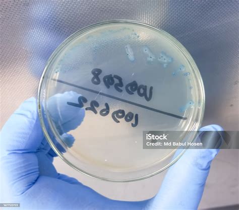 Technologist Holds Bacteria Culture Growth On Chromogenic Media Plate