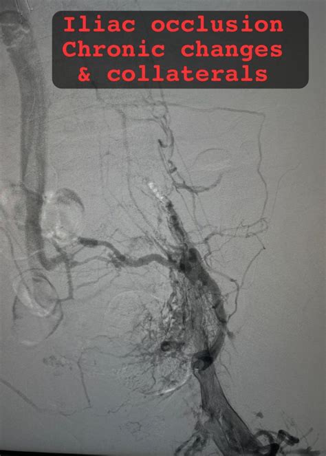 Yahya Al Asiri On Linkedin Ir Venous Ir Venous Ir Ir Venous Irad
