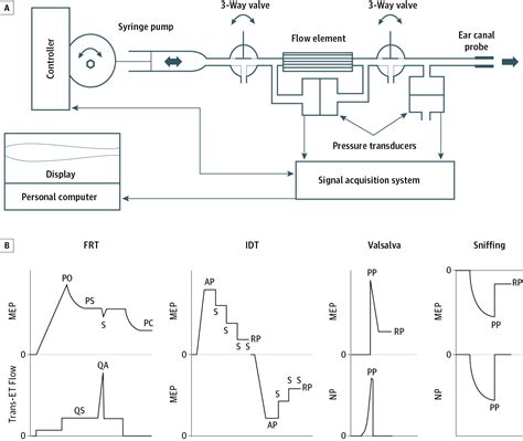 Eustachian Tube Function Test Ppt At Crystal Twyman Blog