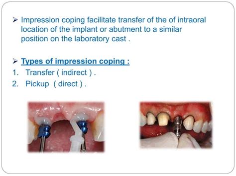 Implant Components And Function Pptx