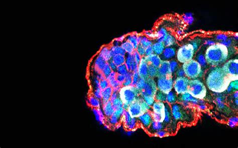 More Than Just X And Y A New Genetic Basis For Sex Determination