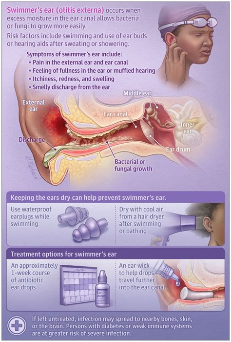 Jama Otolaryngology On Linkedin What Is Swimmers Ear This Patient
