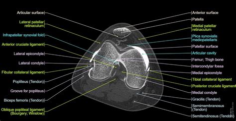 Anatomy Of The Knee Ct Arthrography E Anatomy