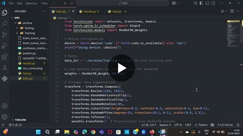 Deeplearning Computervision Mri Braintumordetection Resnet50