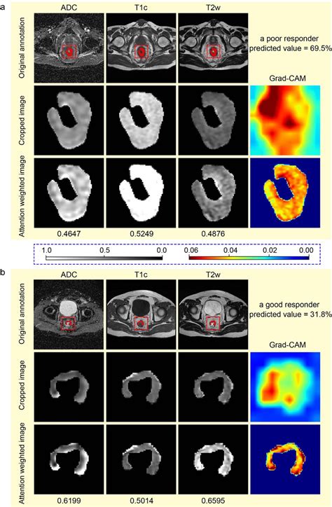 grad cam heatmap of the last max pooling layer and the first se block download scientific