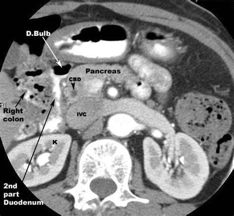 Course Of Esophagus