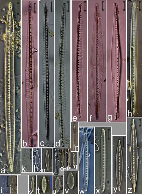 A Y Z Bacillaria Socialis B C Nitzschia Longa D E N Insignis Download Scientific