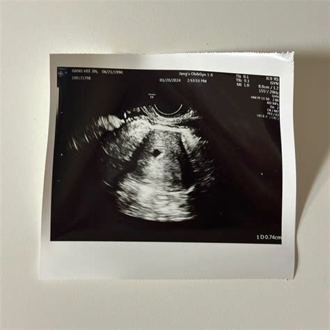 임신 5주차 임테기 두 줄 산부인과 임밍아웃 태명 짓기 4w 5w 극초기 증상 네이버 블로그