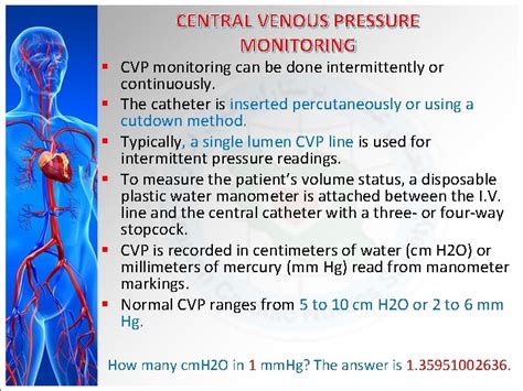 Examples Of Invasive Hemodynamic Monitoring At Victoria Dearth Blog