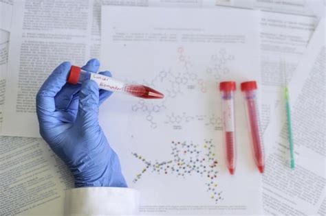 Chemosensor Could Detect Cancer Before Symptoms Arise Medical Design And Outsourcing