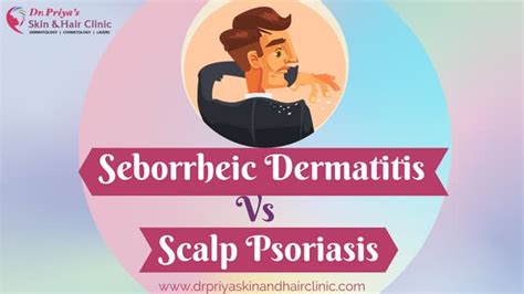 Scalp Psoriasis Vs Seborrheic Dermatitis Ppt