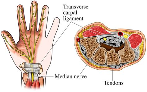 Median Nerve Carpal Tunnel