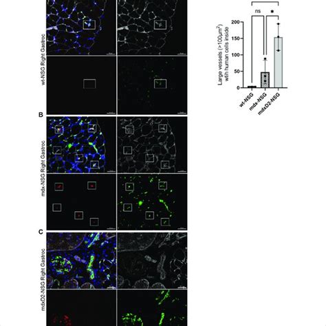 The Severity Of Dmd Mouse Model Impacts Systemic Human Skeletal Muscle Download Scientific