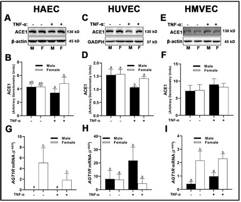 Tissue Derivation And Biological Sex Uniquely Mediate Endothelial Cell