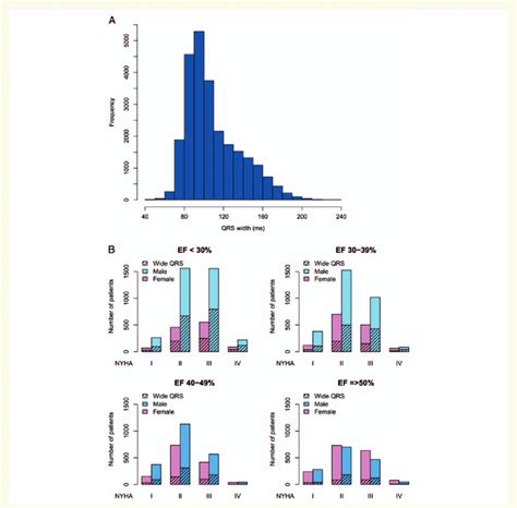 QRS Width Distribution A Histogram Of QRS Width Ms B QRS Width Download Scientific
