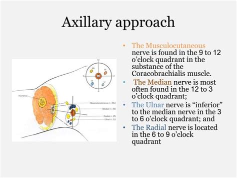 Brachial Plexus Blocks Pptx