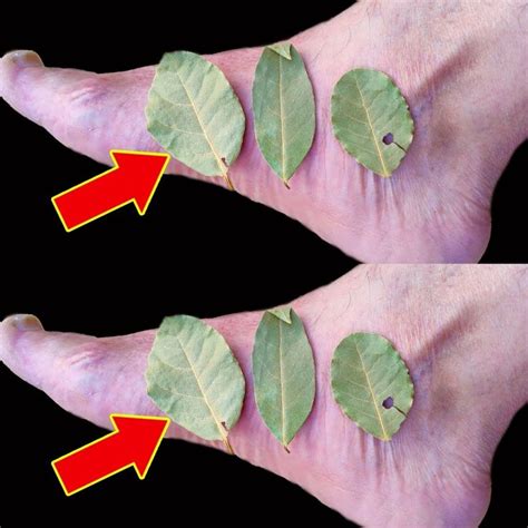 Descubre Los Beneficios De La Hoja De Laurel Para Tus Pies Un Remedio