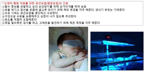 댓글 간호조무사 아동간호 황달치료 광선요법