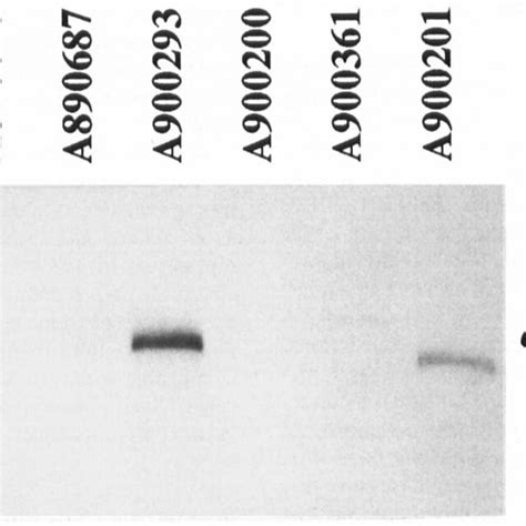 Northern Blot Analysis Of Whole Cell Rna From Representative Isolates