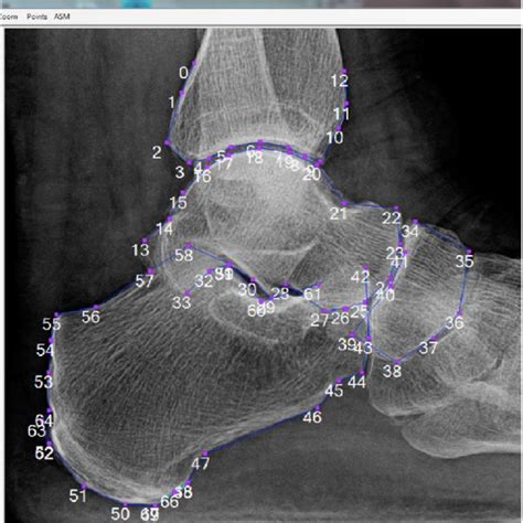 68 Point Statistical Shape Model Of The Lateral Ankle Download Scientific Diagram
