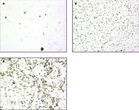 Microscopic Evaluation Of Amorphous Urate Crystals Quantitative Grading Download Scientific