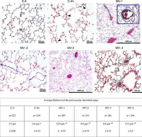Lung Parenchyma Histology Pulmonary Pathology