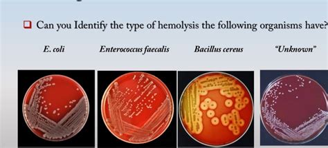 Solved Can You Identify The Type Of Hemolysis The Following