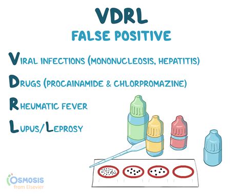 VDRL False Positive VDRL Results Mnemonic Osmosis