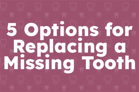 5 Options For Replacing A Missing Tooth Midpark Dental