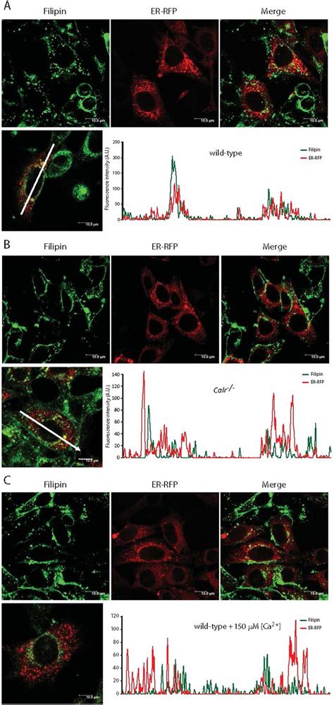 Intracellular Distribution Of Cholesterol In Wild Type And Download Scientific Diagram