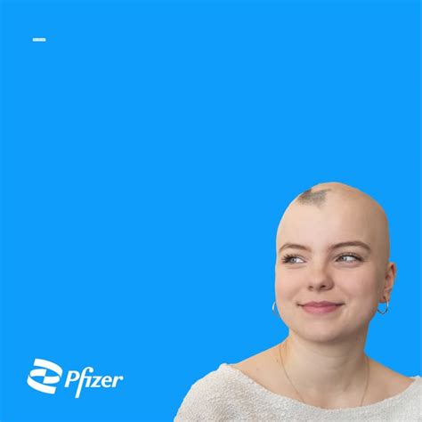 Video Melissa Reinbold On Linkedin I Was Diagnosed With Alopecia 18 Years Ago I Started