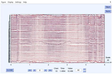 Matlab脑电数据处理精要（三、实操） 知乎