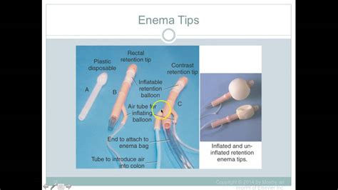 Barium Enema Tip