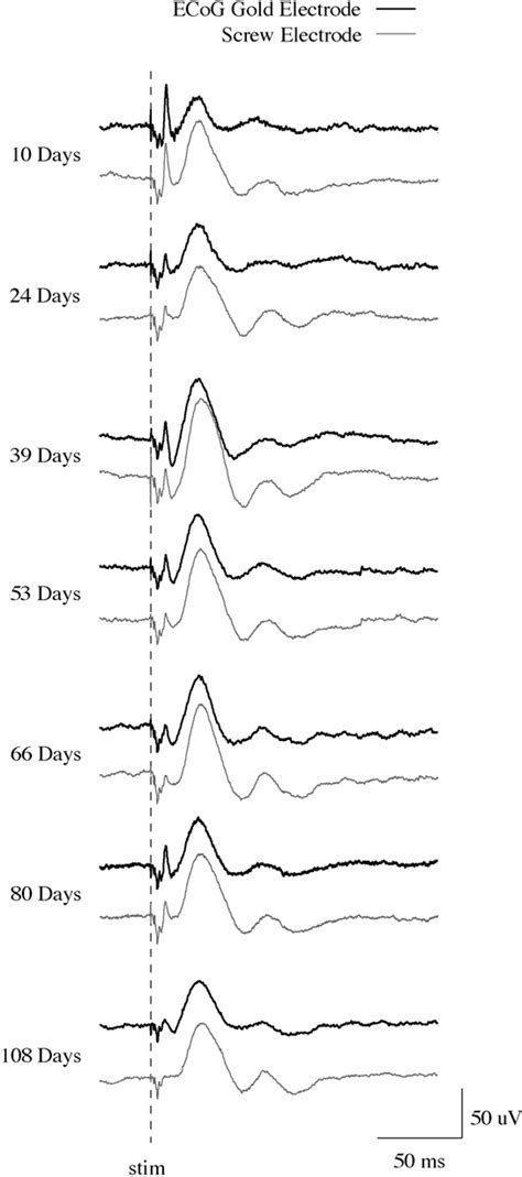 Figure 6 From Characterization Of Flexible Ecog Electrode Arrays For